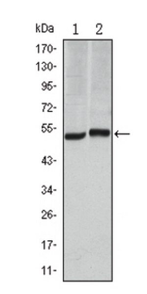 Anti-CA9 Antibody, clone 2D3 | MABN713